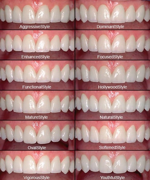 Cerec® Porcelain Crowns Procedure Types Strength And Durability