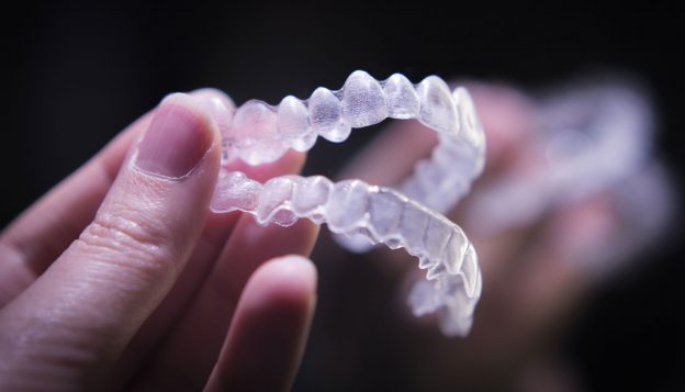 What Causes Crowded Teeth and How to Fix Them - Sarasota Dentistry